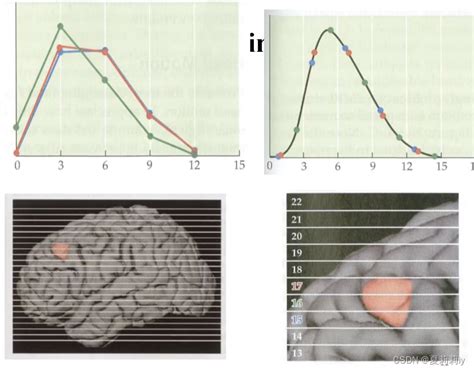 静息态功能磁共振成像rs Fmri原理与数据分析学习笔记（3）：r Fmri Data Processing Dparsfarfmri