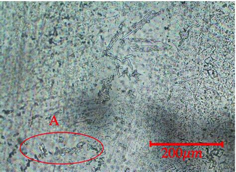 Optical Microscopy Image Of Pure Pvdf Hfp Download Scientific Diagram