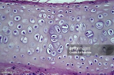 Cartilage Matrix Photos And Premium High Res Pictures Getty Images