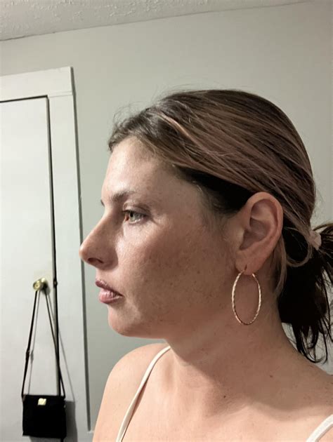 What Type Of Nose Do I Have Rnoses