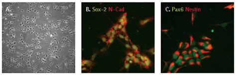 Robust Differentiation Of Human Ipscs Into Lineage Specific Neurons And Glial Cells Utilizing