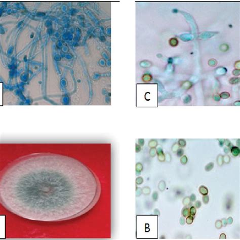 Micromorphology Of Trichoderma Asperellum Isolate 4 Trichoderma