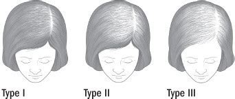 Treating Female Pattern Hair Loss Harvard Health