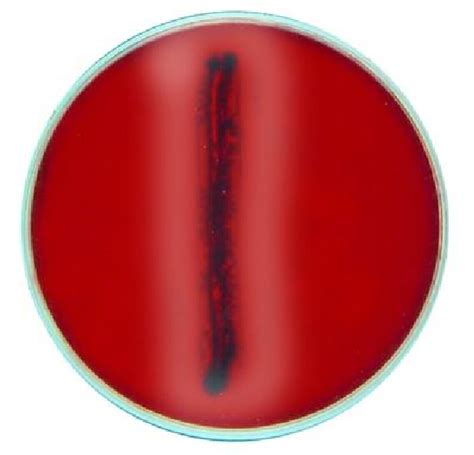 Carboxymethyl Cellulase Activity Staining Of S Lividans On Cmc Agar