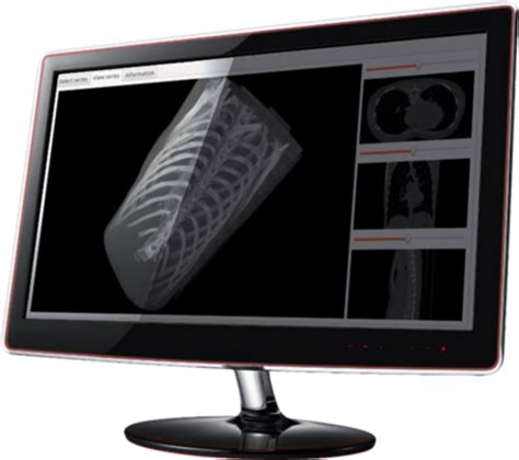 Orthanc DICOM Server