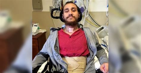 First Neuralink Patient Alarmed As Device Starts Losing Functionality