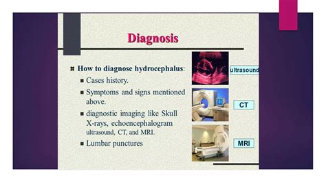 Hydrocephalus Ppt