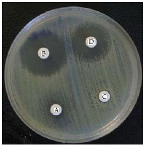 Detection Of Ampc β Lactamases Producing Isolates Among Carbapenem Resistant P Aeruginosa