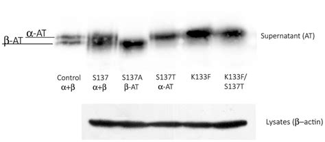 Expression Of Antithrombin Variants Sds Page Under Reducing Conditions