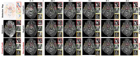 Figure 3 From Bridging MRI Cross Modality Synthesis And Multi Contrast