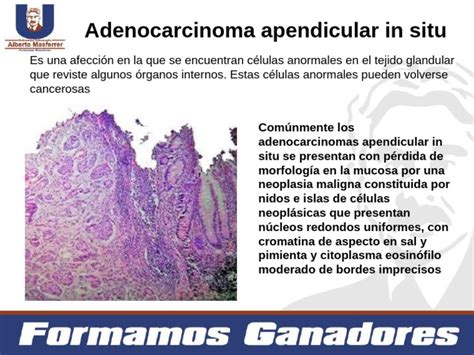 Adenocarcinoma Apendicular In Situ Pdf