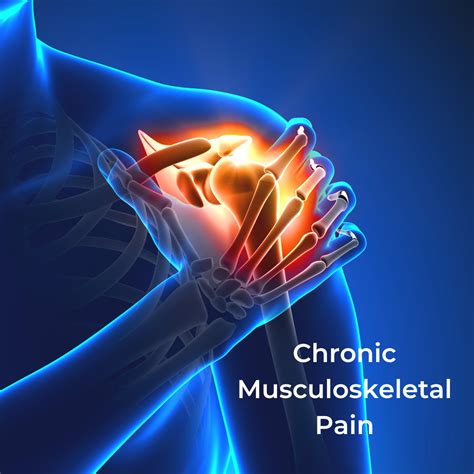 Clinical Recommendations For Chronic Musculoskeletal Pain In South