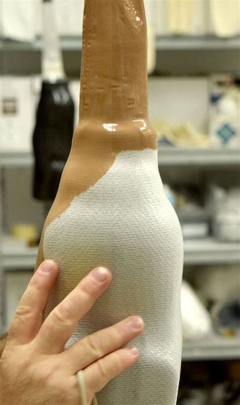 Prosthetic Socket Fabrication In Texas Grace Prosthetic