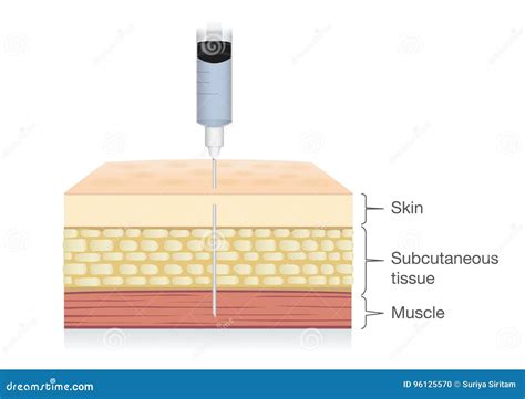 Subcutaneous Fat Level Vector Illustration 279323914
