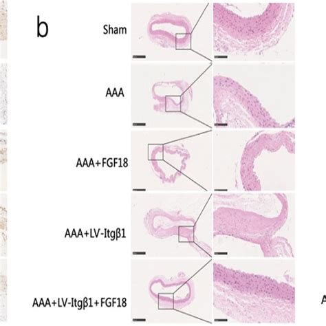 A Immunohistochemical Staining Itgβ1 Was Mainly Expressed In The