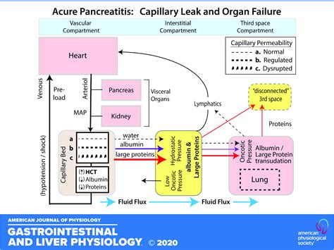 Severe Acute Pancreatitis Capillary Permeability Model Linking