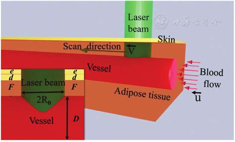 Modeling Of Nanoparticle Sensitized Spatially Localized Dynamic