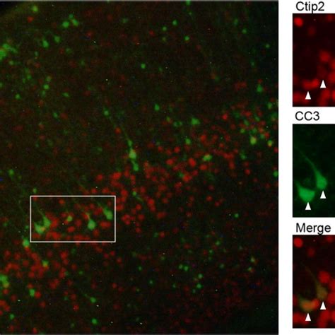 Immunolabeling For Cleaved Caspase 3 Cc3 8 H After P7 Ethanol