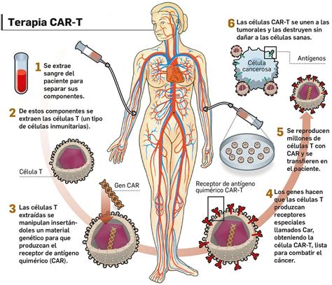 Recent Advances In Ewing Sarcoma Renew Hope Postposm