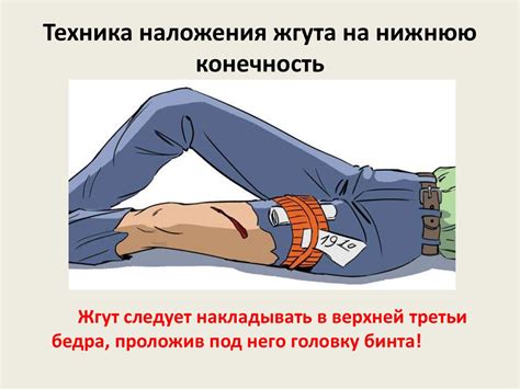 Техника наложения жгута на верхнюю конечность презентация онлайн