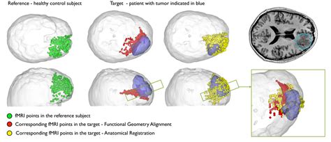 Functional Geometry Alignment And Localization Of Brain Areas