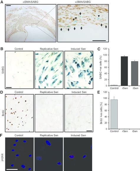Vascular Smooth Muscle Cell Vsmc Senescence Which Occurs In Mature