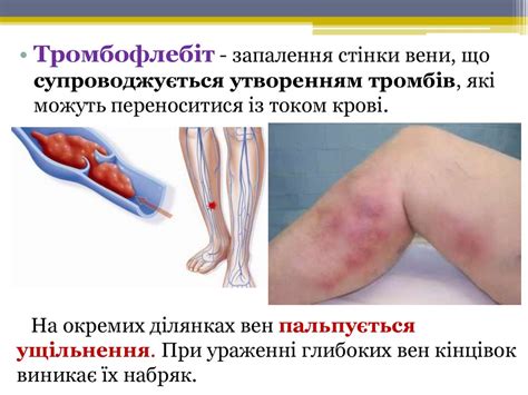 Догляд за хворими з хірургічними захворюваннями і ушкодженнями кінцівок