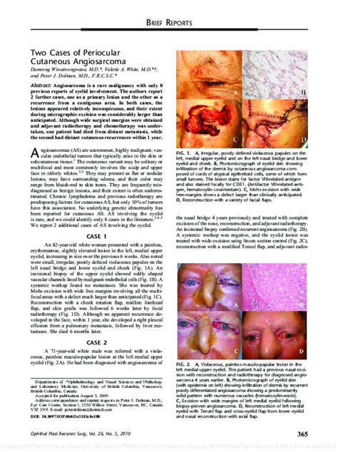 Pdf Pseudodacryocystitis And Nasolacrimal Duct Obstruction Secondary