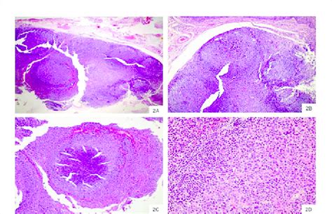 A Lamina Propria Of Connective Tissue Showing Dense Lymphoid Download Scientific Diagram