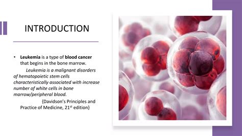 Leukemia Presentation Ppt