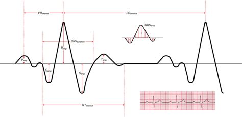 Figure 1 From Recgnition V1 0 Arrhythmia Detection Using Cardiologist