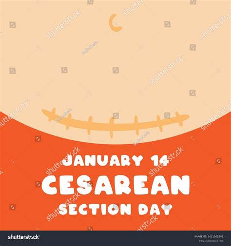 11 Cesarean Hysterectomy Stock Vectors And Vector Art Shutterstock