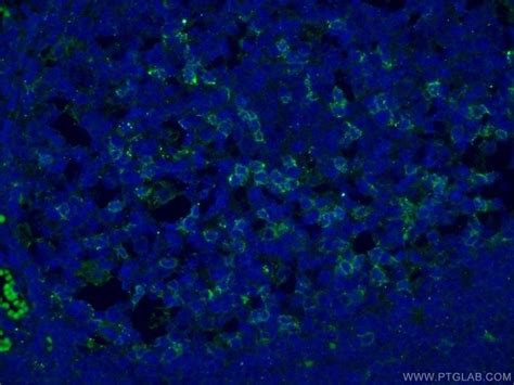 Pd 1cd279 Mouse Anti Human Mouse Rat Clone 4h4d1 Proteintech 20