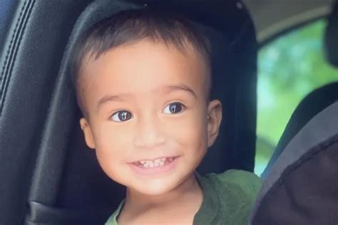 Microtia And Atresia Resources Microtia Atresia Australia