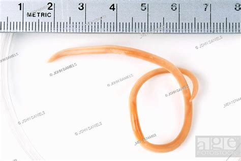 Toxocara Cati Cat Roundworms Youtube