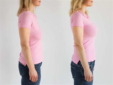 How Is Recovery With Tummy Tuck And Breast Lift Grossman