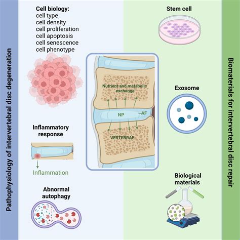 Intervertebral Disc Treatment Biorender Science Templates