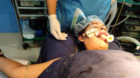 Wake Up After Surgery