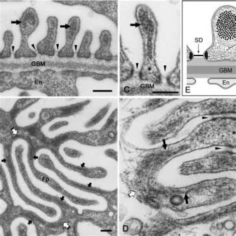 Electron Micrographs Of Podocyte Foot Processes Electron Microscopic