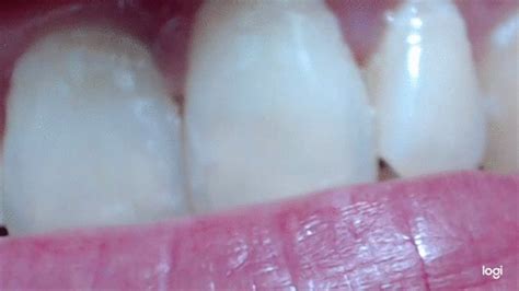 2 Minutes My White Teeth To Cam So Nice Natural And Feminine Teeth Mp4