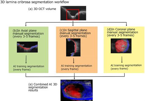 workflow of deep learning based 3d oct imaging of the lamina cribrosa
