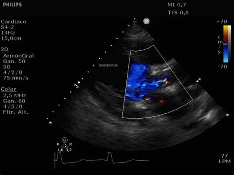 Issac Cheong On Linkedin Pocus Echo