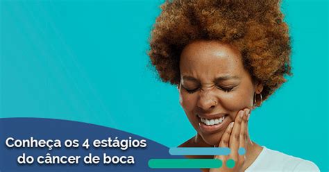 Conheça os 4 estágios do câncer de boca Dr Rafael De Cicco