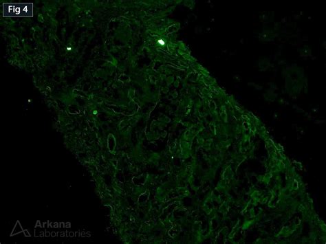 Congo Red Staining Teaching Points Arkana Laboratories