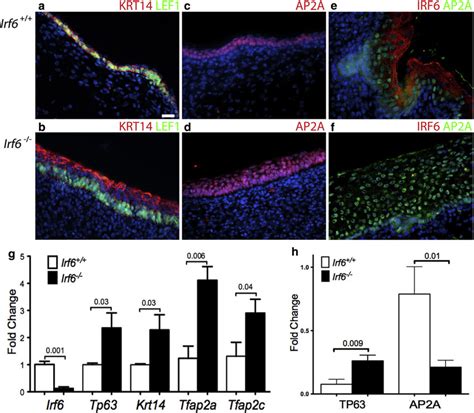 Irf6 Regulates Tfap2a Aef Loss Of Irf6 Leads To Ectopic Ap2a Protein Download Scientific