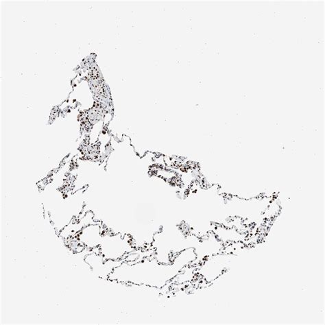 Tissue Expression Of Cebpb Staining In Lung The Human Protein Atlas