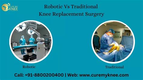 Robotic Knee Replacement Vs Traditional Knee Replacement Surgery