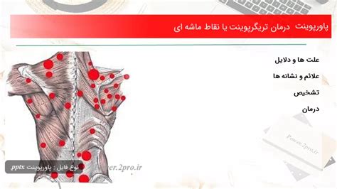 دانلود پاورپوینت درمان تریگرپوینت یا نقاط ماشه ای کد107485