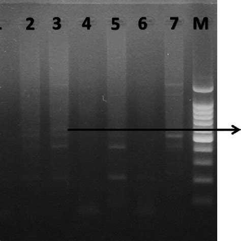 Reverse Transcription Polymerase Chain Reaction Electrophoresis Result
