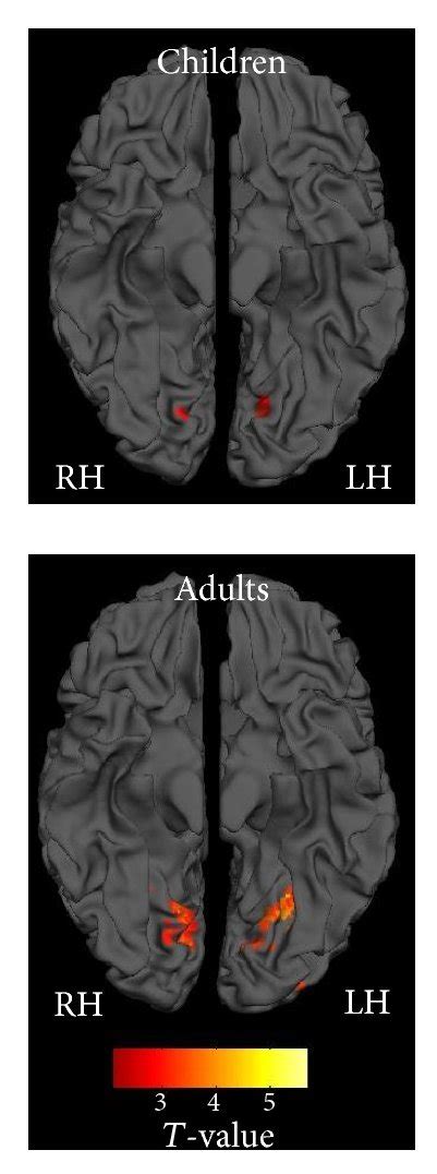Interhemispheric Integration Effects As Revealed By Fmri Activation And